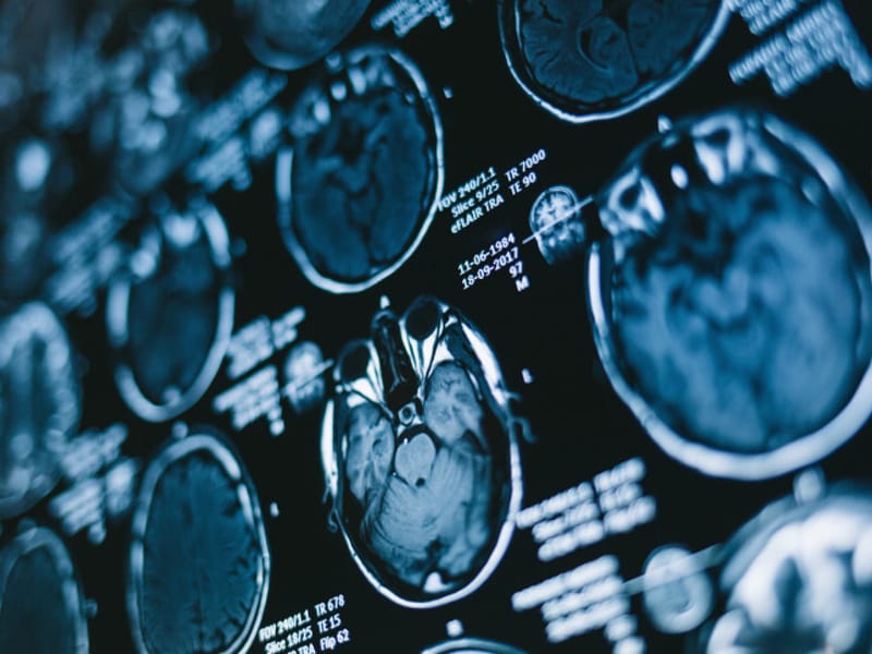 Wellumio investment offer preview – Snowball Effect